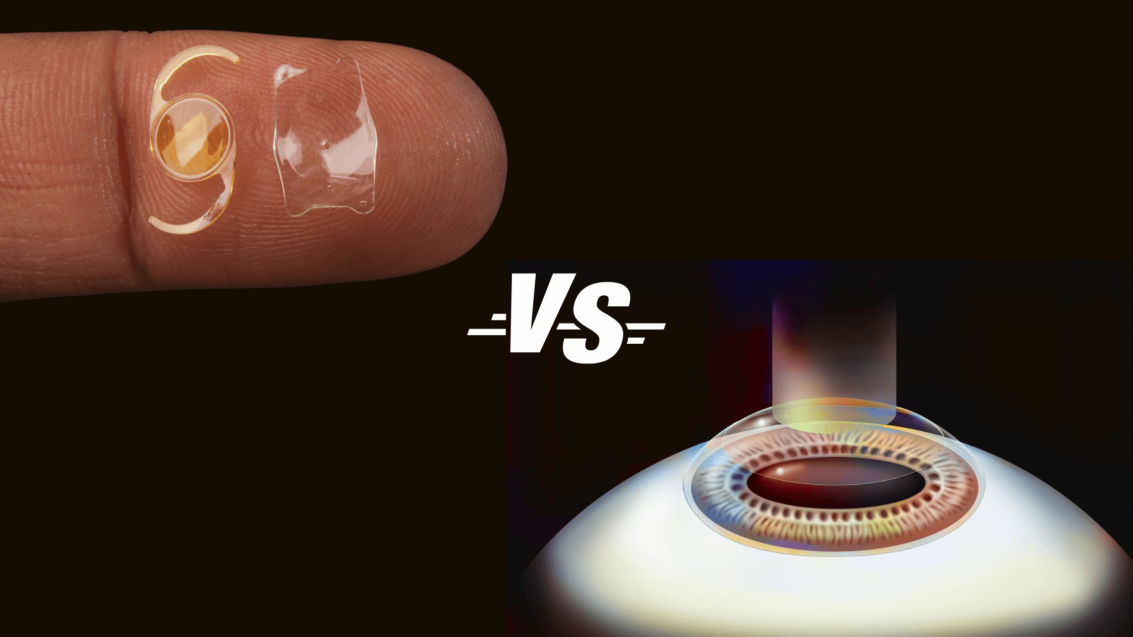 ICL Vs. LASIK - Which One’s Right For You? – SuraVision